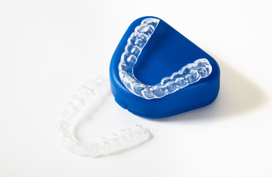Invisalign Attachments: How They Work, Benefits, and Care – Diamond Braces