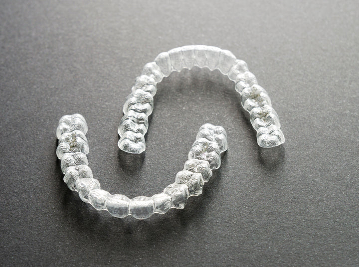 Spark Aligners vs Invisalign: An Honest Comparison – Diamond Braces