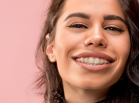 Ceramic & Invisible Braces | Diamond Braces
