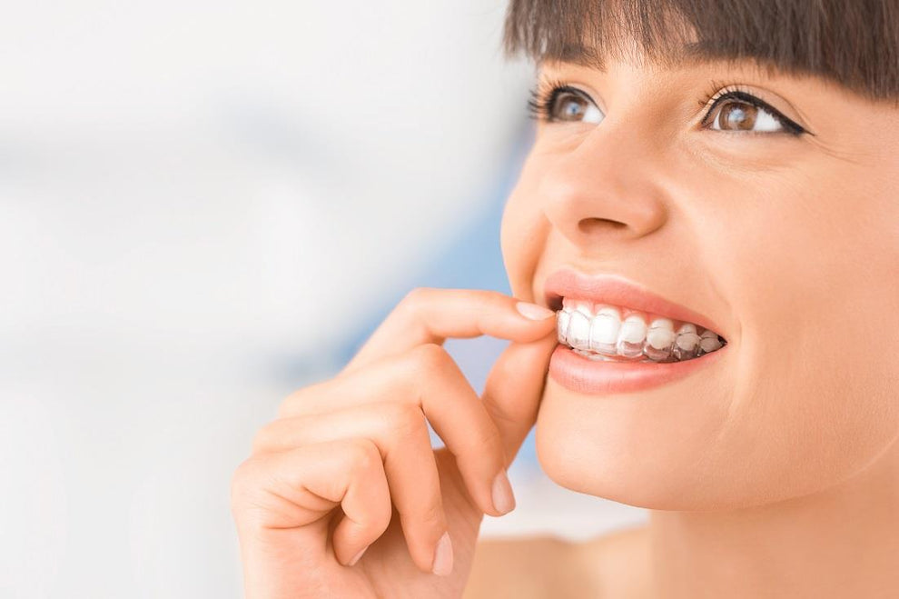 Invisalign Aligners & Clear Braces | Diamond Braces