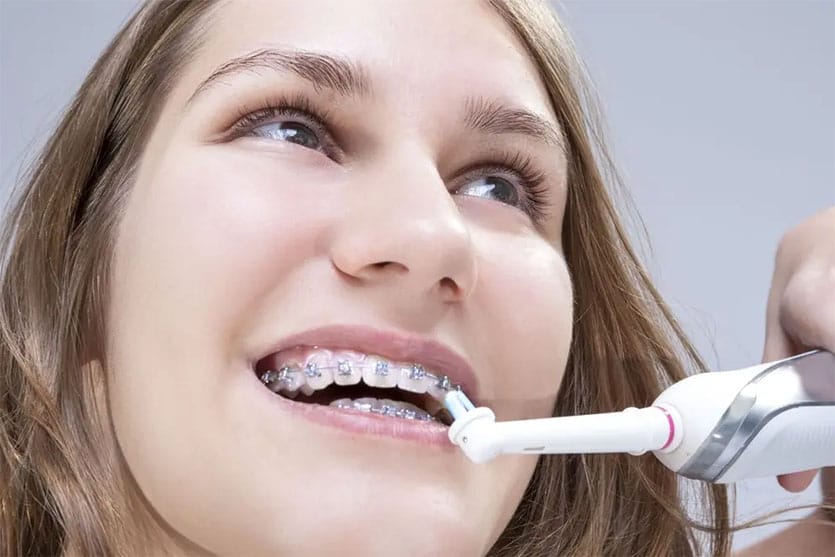 Do Electric Toothbrushes Work Well with Braces Diamond Braces